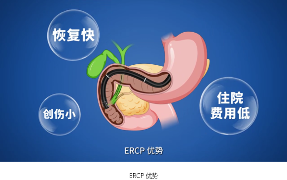 佳能医疗与奥林巴斯战略合作签约 携手打造安心高效的ERCP整体解决方案_深圳之窗